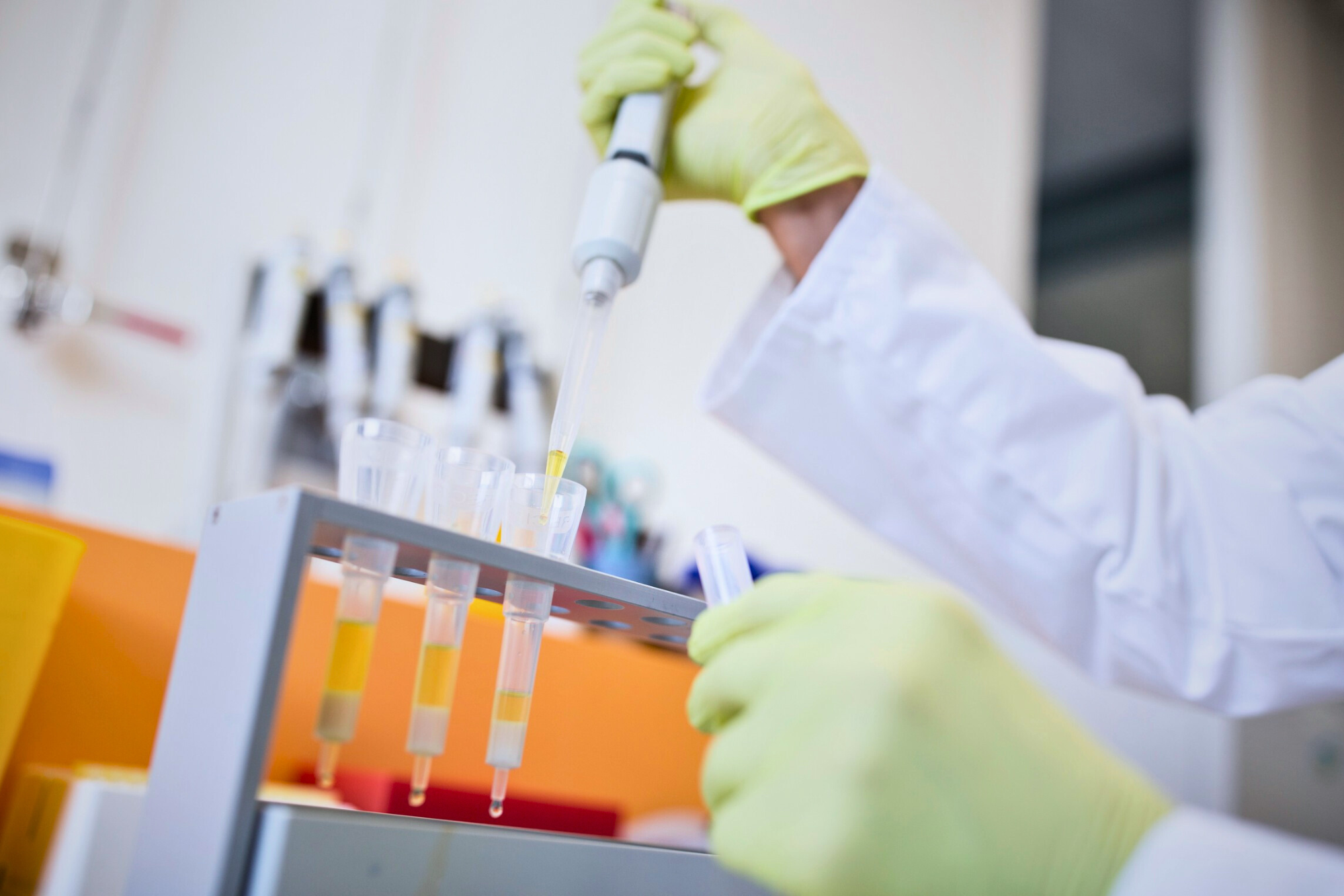 Differences Between Solid Phase Extraction Spe And Solid Phase Micro Extraction Spme